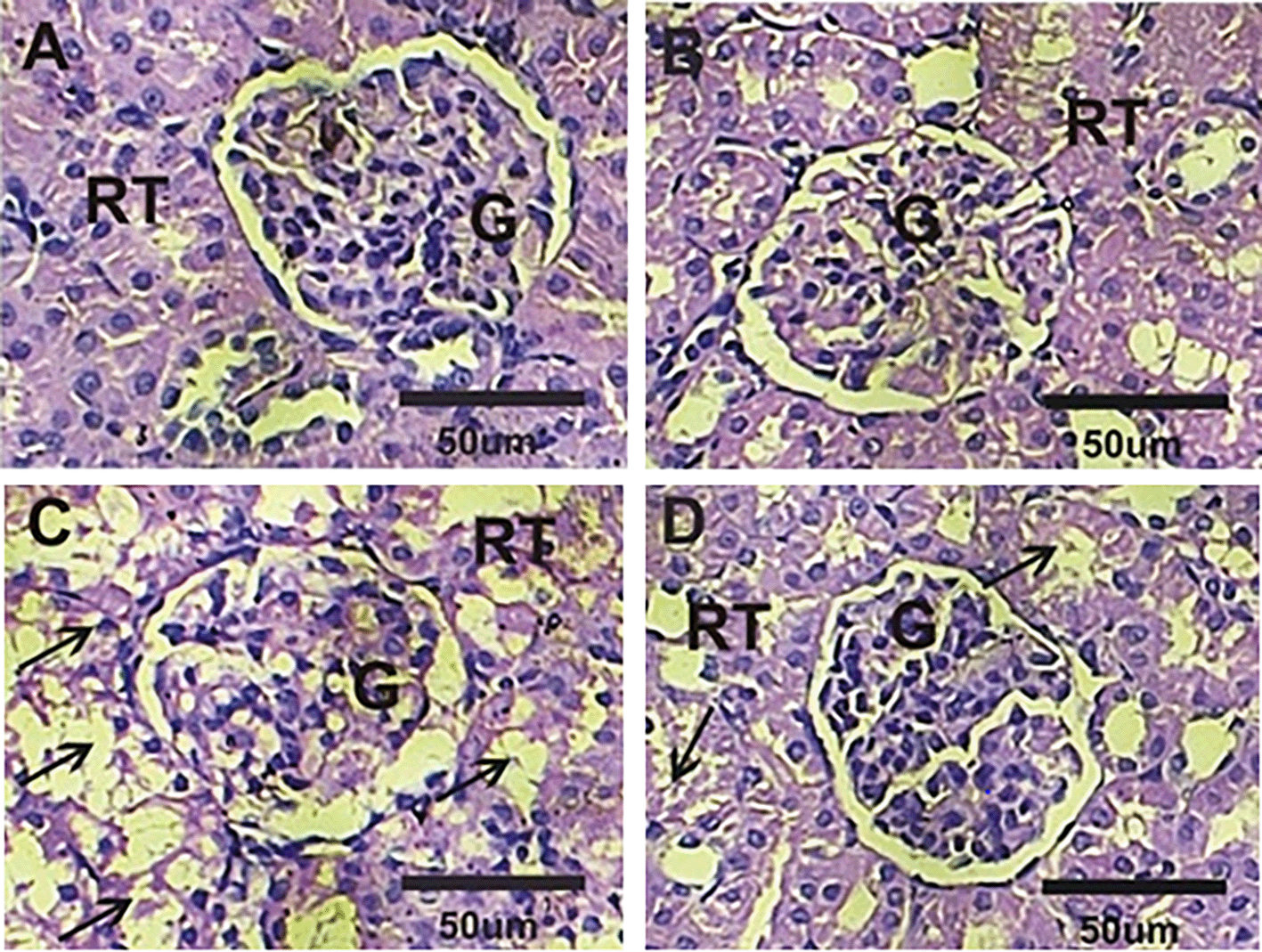The Potential Mitigating Effect of Curcumin Root... | F1000Research
